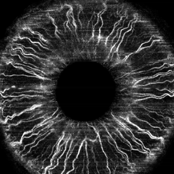 ACA & ONH – Intalight