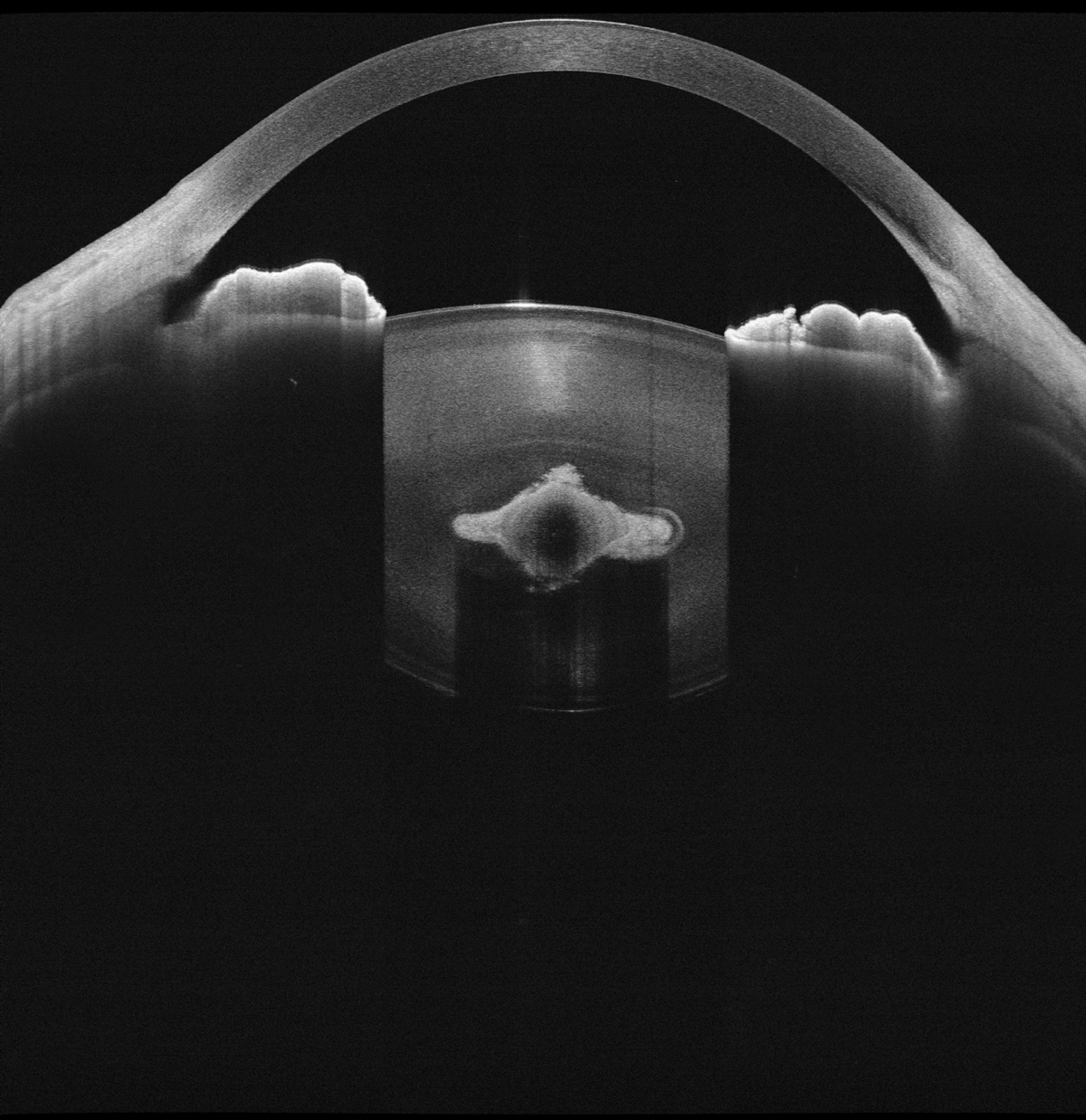 DREAM OCT™ – Intalight