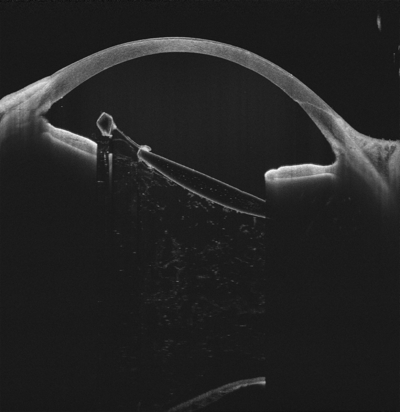 DREAM OCT™ – Intalight