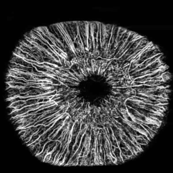 DREAM OCT™ – Intalight