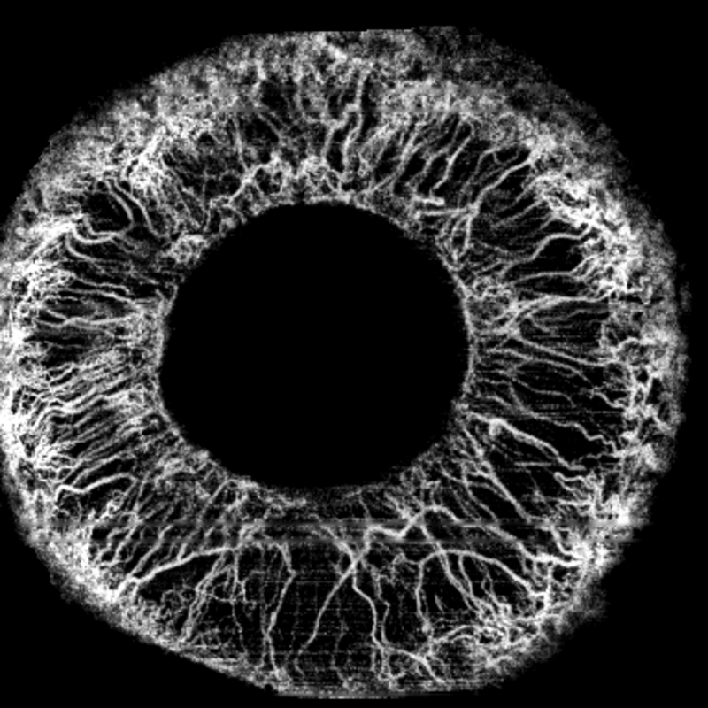 DREAM OCT™ – Intalight