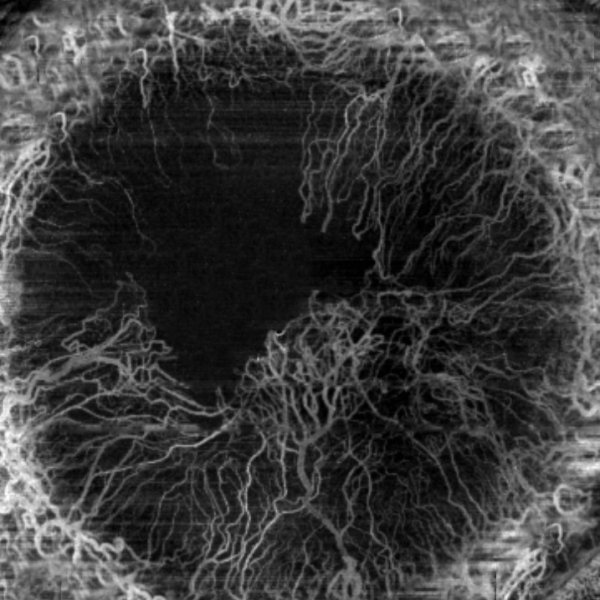 DREAM OCT™ – Intalight