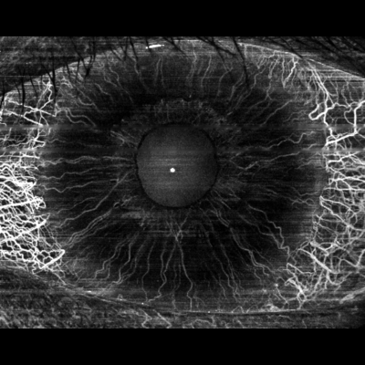 DREAM OCT™ – Intalight