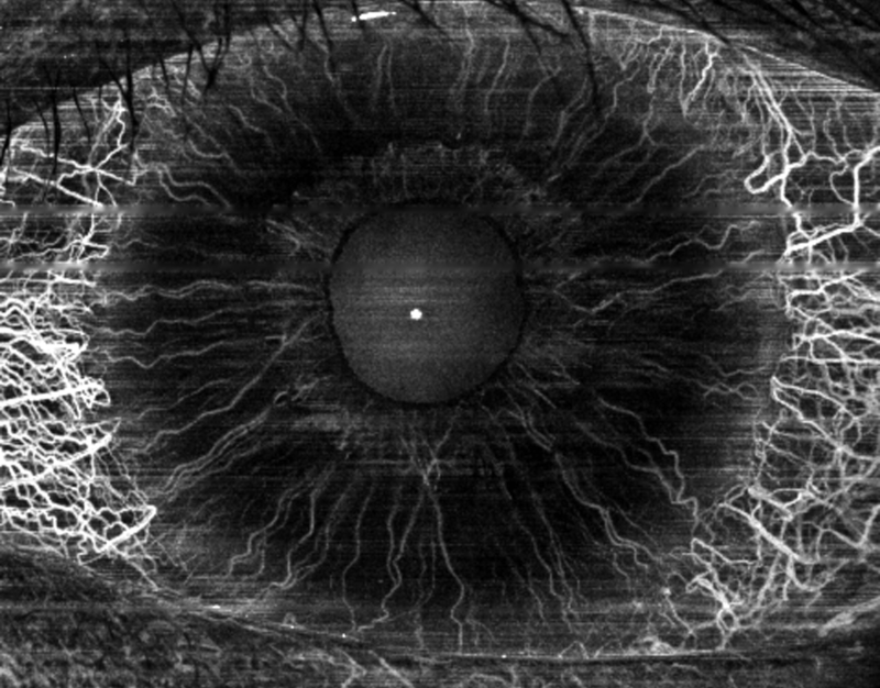 DREAM OCT™ – Intalight