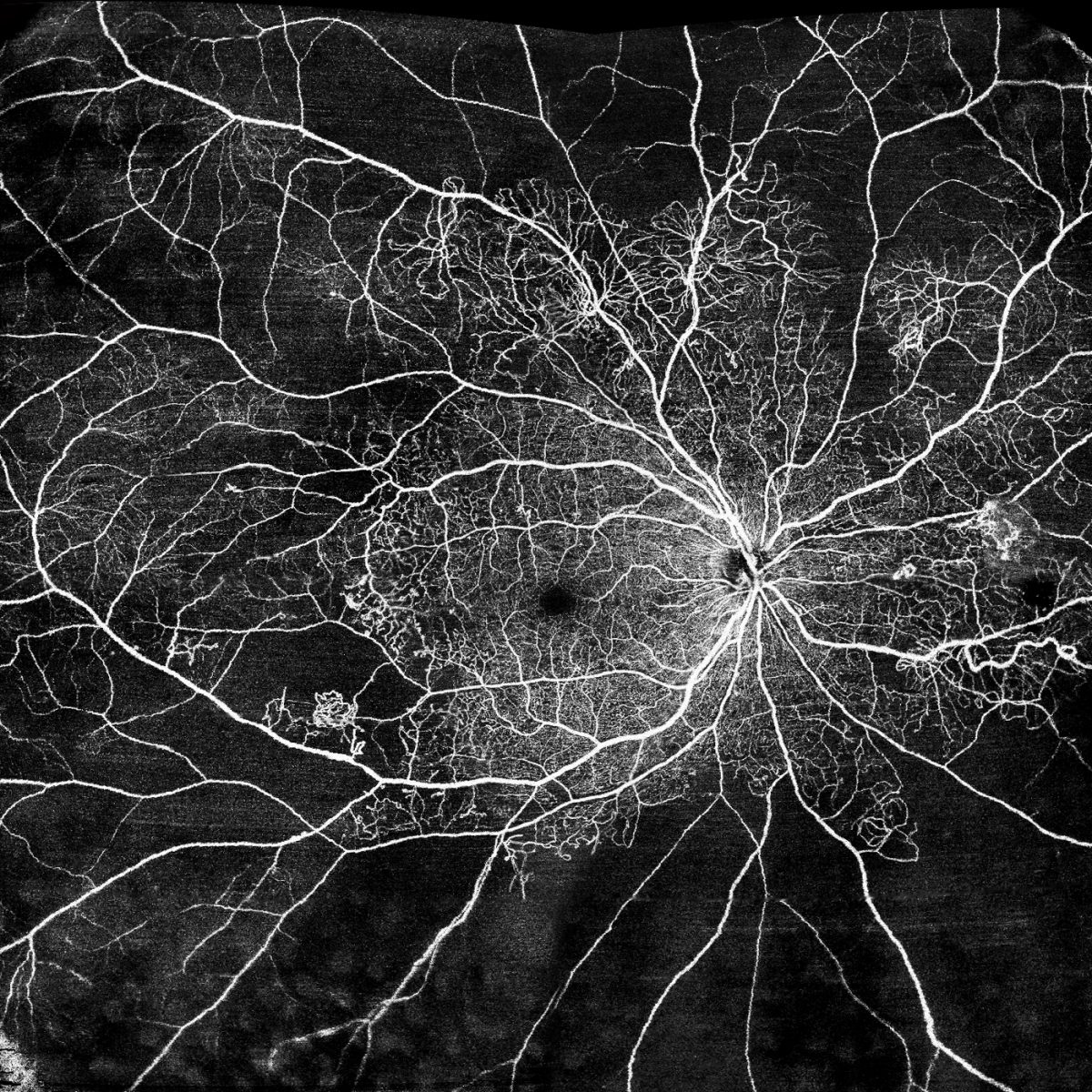 DREAM OCT™ – Intalight