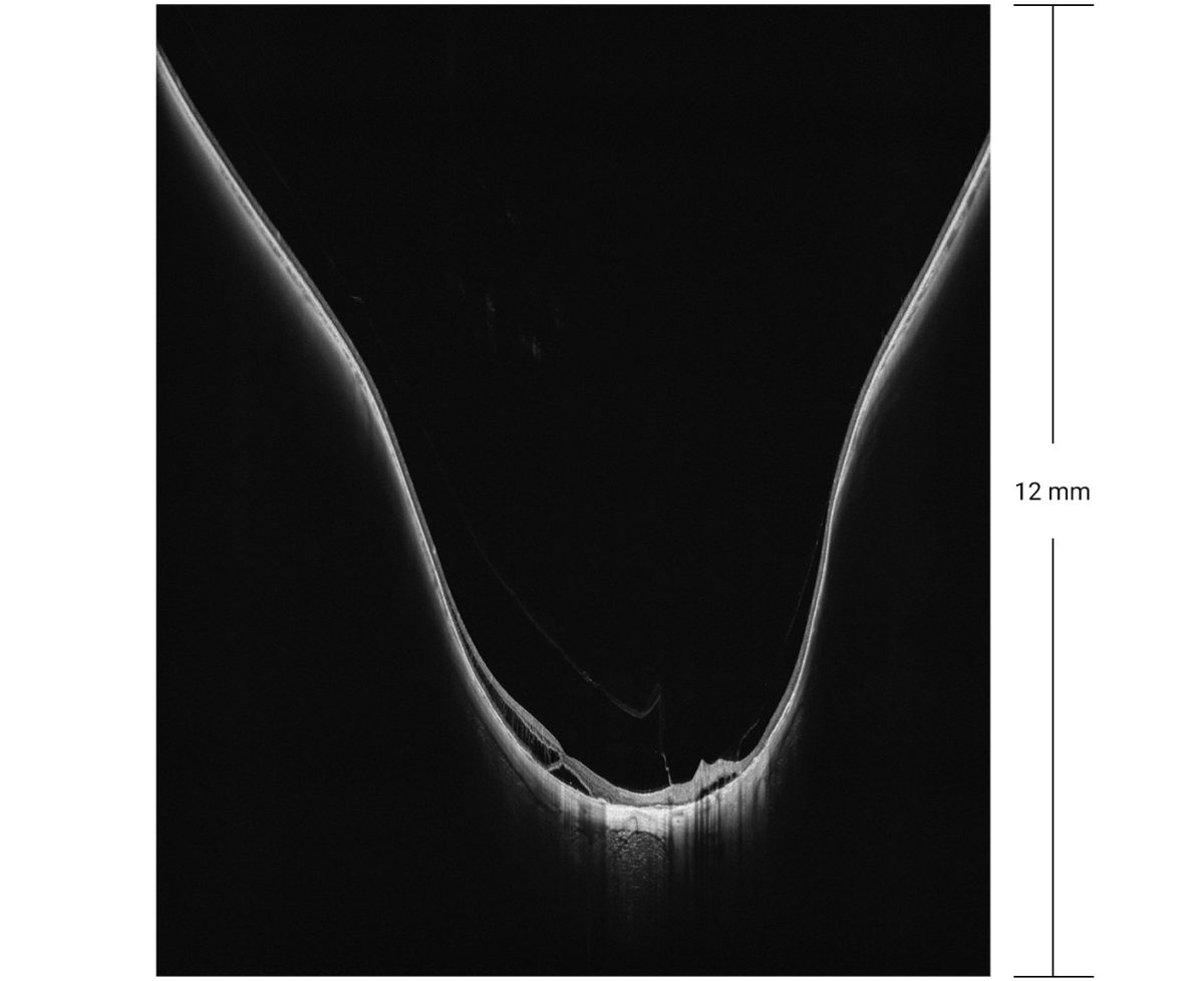 DREAM OCT™ – Intalight