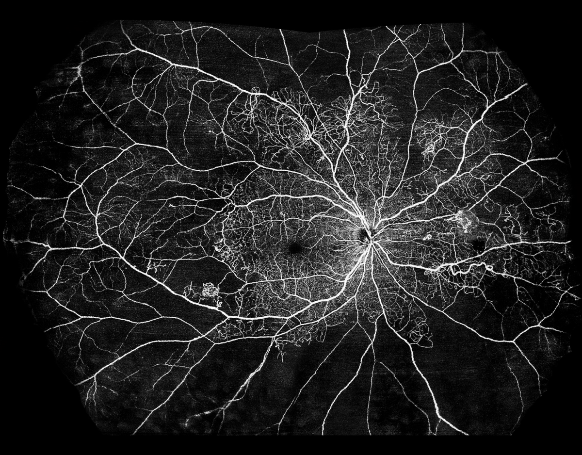 DREAM OCT™ – Intalight