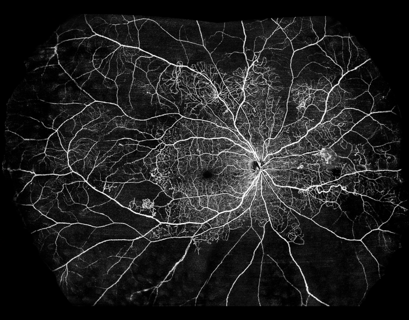 DREAM OCT™ – Intalight